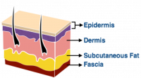 Wound Care 101: An Overview Of Wound Types And Treatment