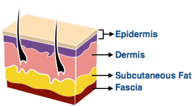 Wound Care 101: An Overview Of Wound Types And Treatment
